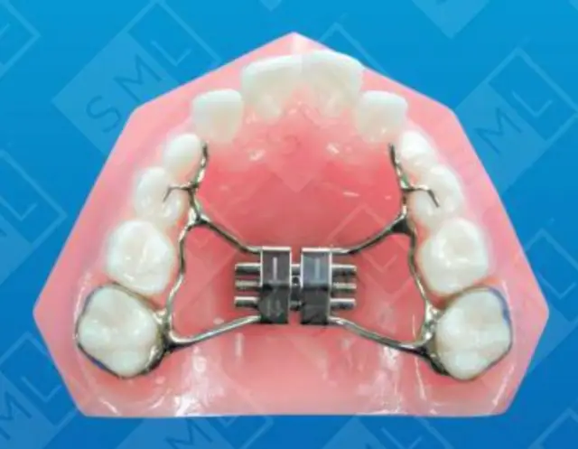 Rapid Palate Expander for Kids and Adults - Complete Guide