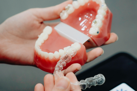 Can You Fix Overbite Naturally Without Braces or Surgery?